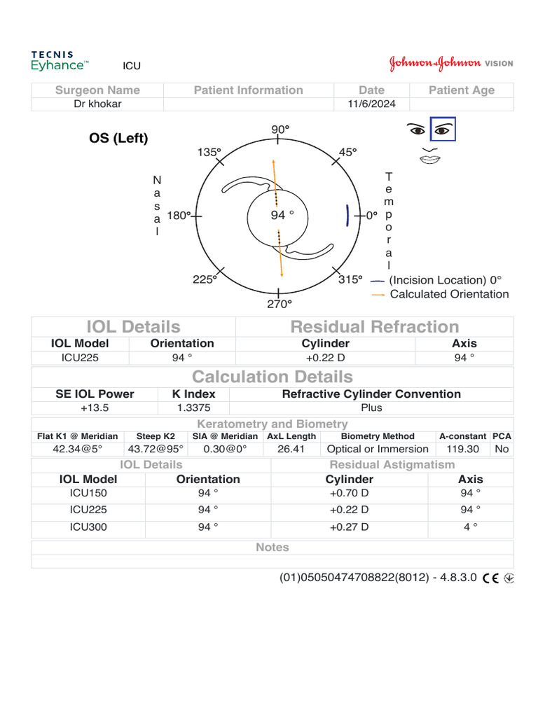 Cataract Surgery IOL Calculation | PDF | Optics | Ophthalmology