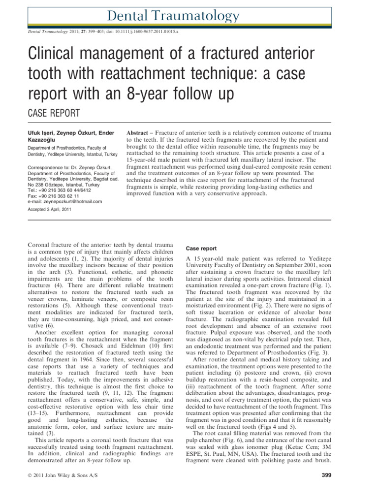 Clinical Management of A Fractured Anterior Tooth With Reattachment ...