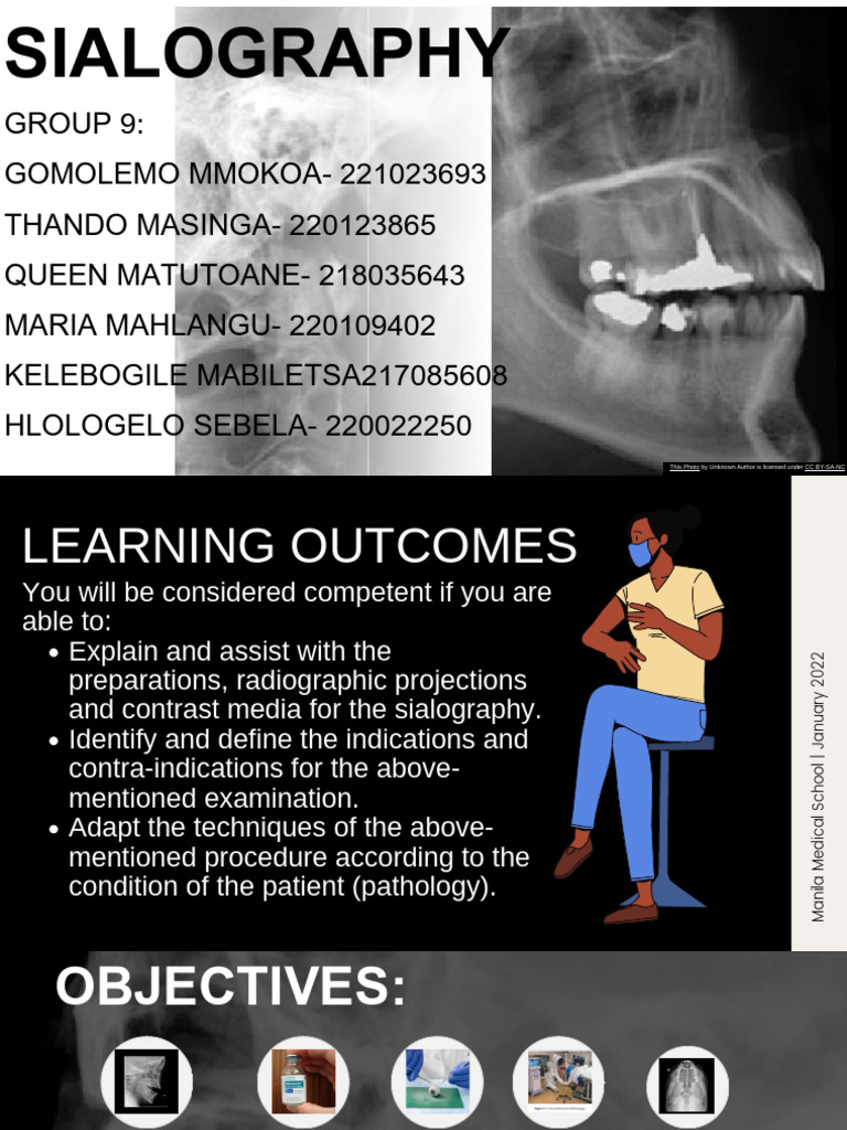 Final Canva 2 Sialography | PDF | Radiography | Ct Scan