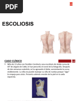 Signo de Risser | PDF | Escoliosis | Rtt