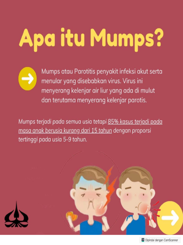 Penyuluhan Mumps & MS | PDF