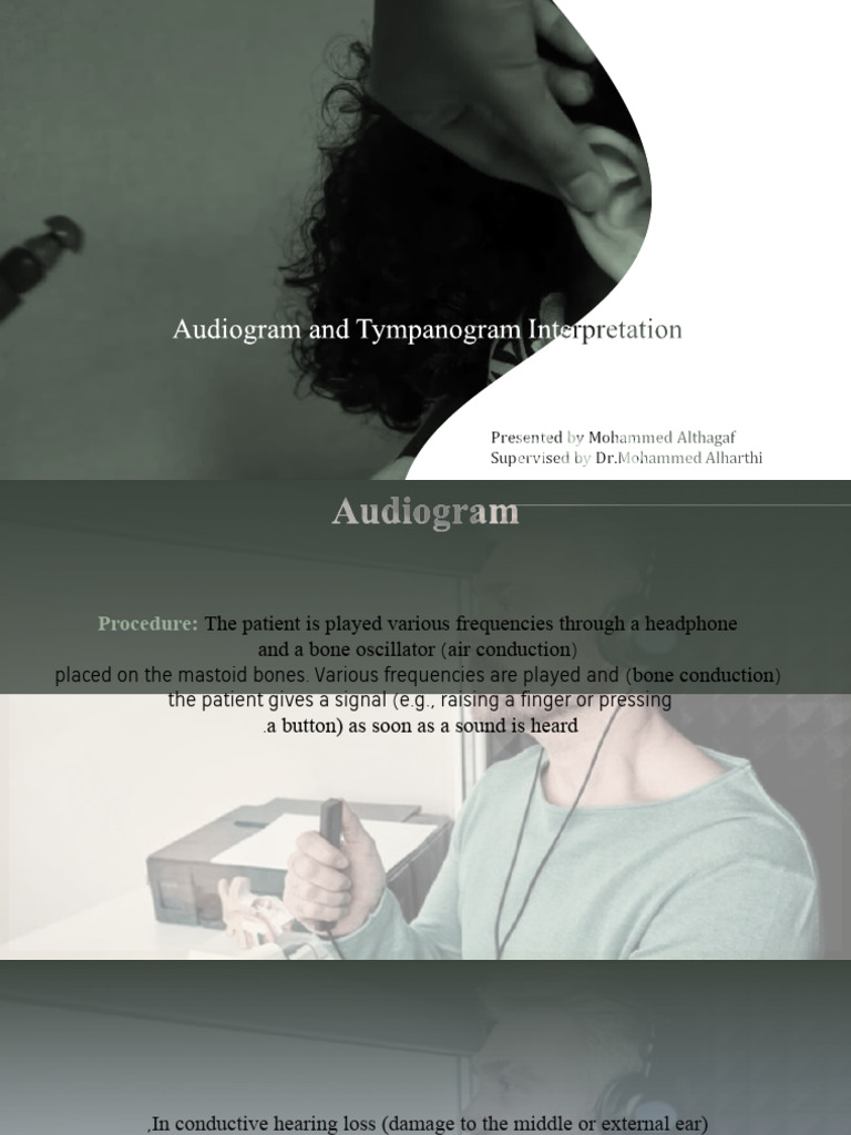 Audiogram and Tympanogram Interpretation 2 | PDF | Wellness