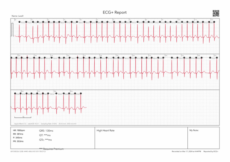 Ecg+ 20240317164438 | PDF