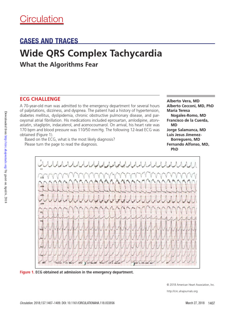 Wide Qrs Complex Tachycardia What The Algorithms Fear Pdf Electrocardiography