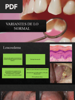 Microglosia y Macroglosia | PDF | Inflamación | Lengua