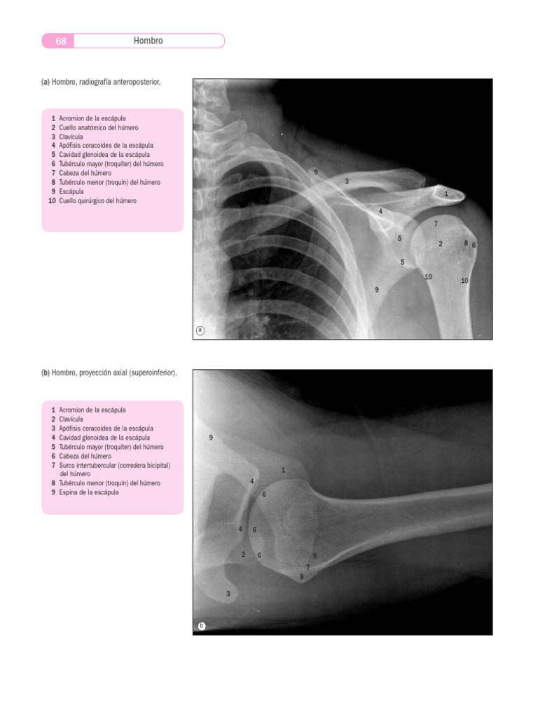 Weir RX Hombro Codo Mano | PDF | Hombro | Extremidades (anatomía)