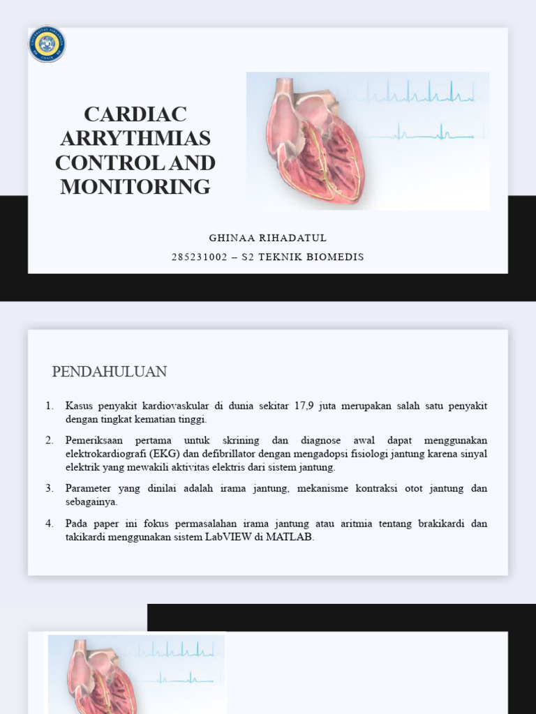 The Optimization of A Closed Loop Medical Device | PDF