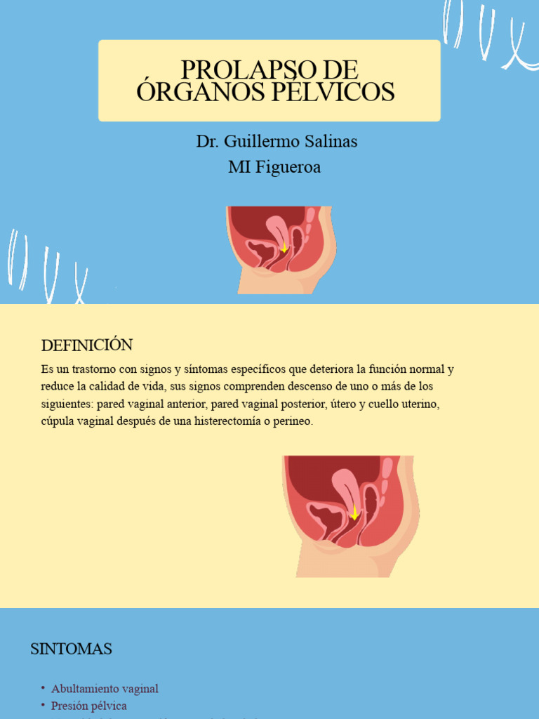 Prolapso de Órganos Pélvicos - Naun | PDF | Vagina | Pelvis