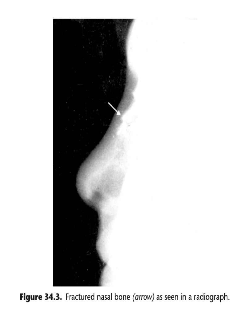 ENT X-Rays (Dhingra - Original) | PDF