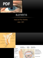 Diferencias entre Blefaritis Anterior y Posterior | PDF | Enfermedades y trastornos | Oftalmología