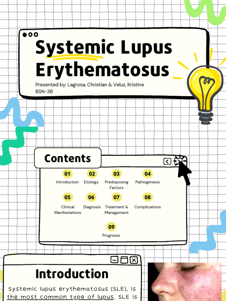 Systemic Lupus 1 | PDF | Autoimmune Disease | Blood Cell