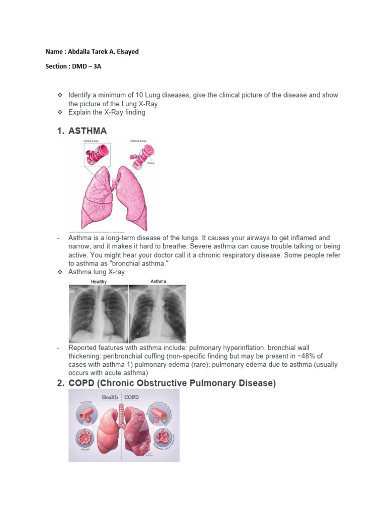 GenPath Lab Activity 13 - Elsayed | PDF | Lung | Respiratory Diseases