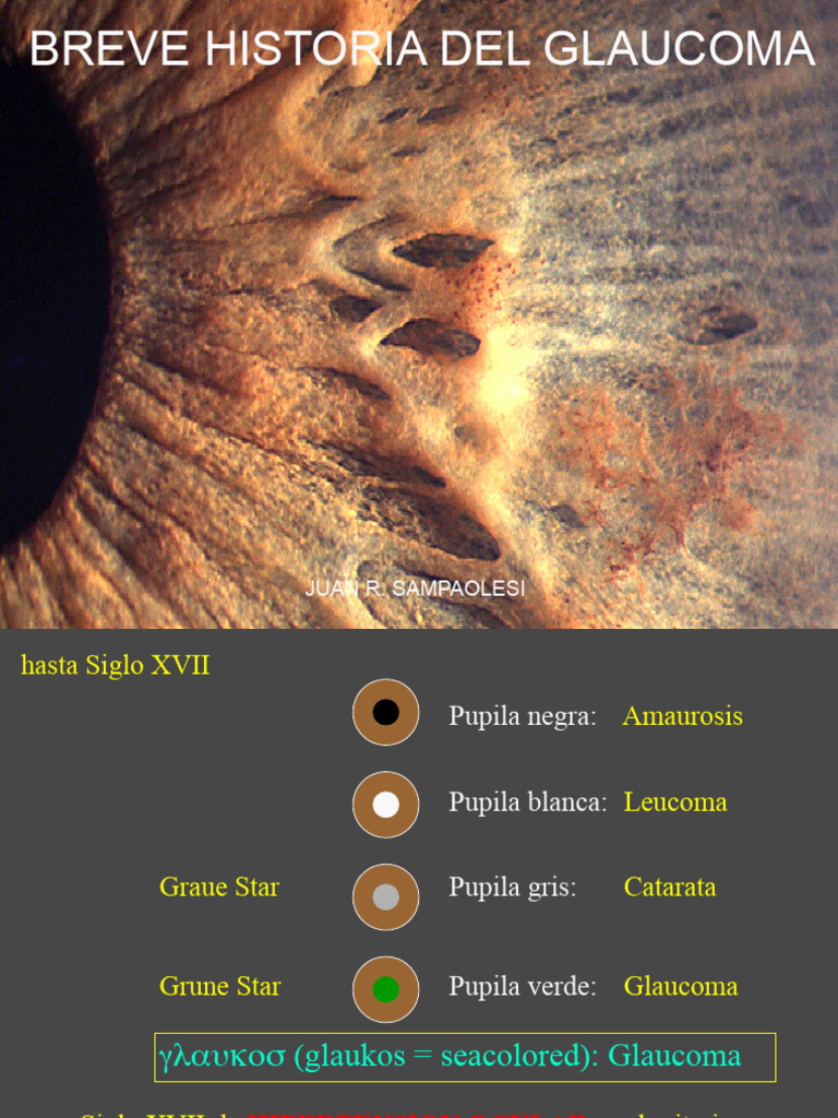 01 Historia y Concepto Glaucoma | PDF | Glaucoma | Sistema visual