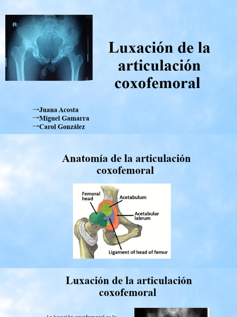Luxación de La Articulación Coxofemoral | PDF | Enfermedades y trastornos | Medicina CLINICA