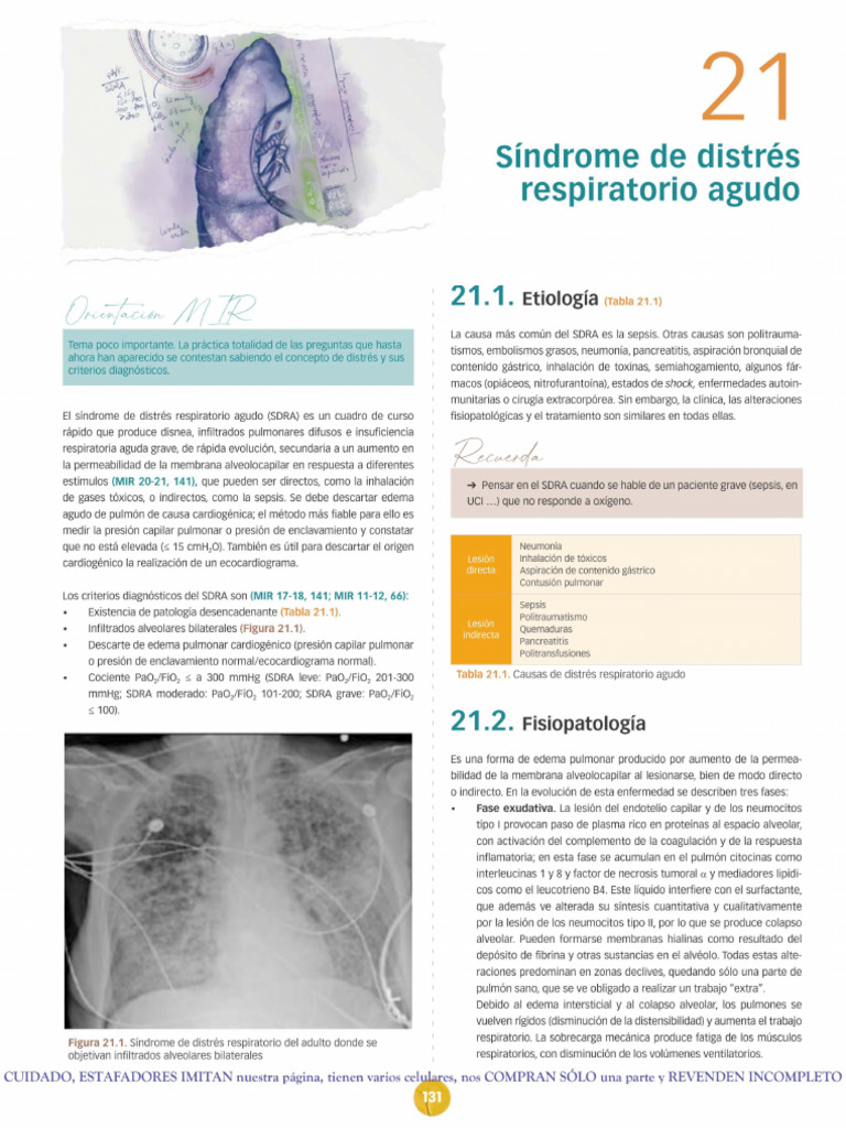 Síndrome de Distrés Respiratorio Agudo | PDF | Neumonía | Septicemia