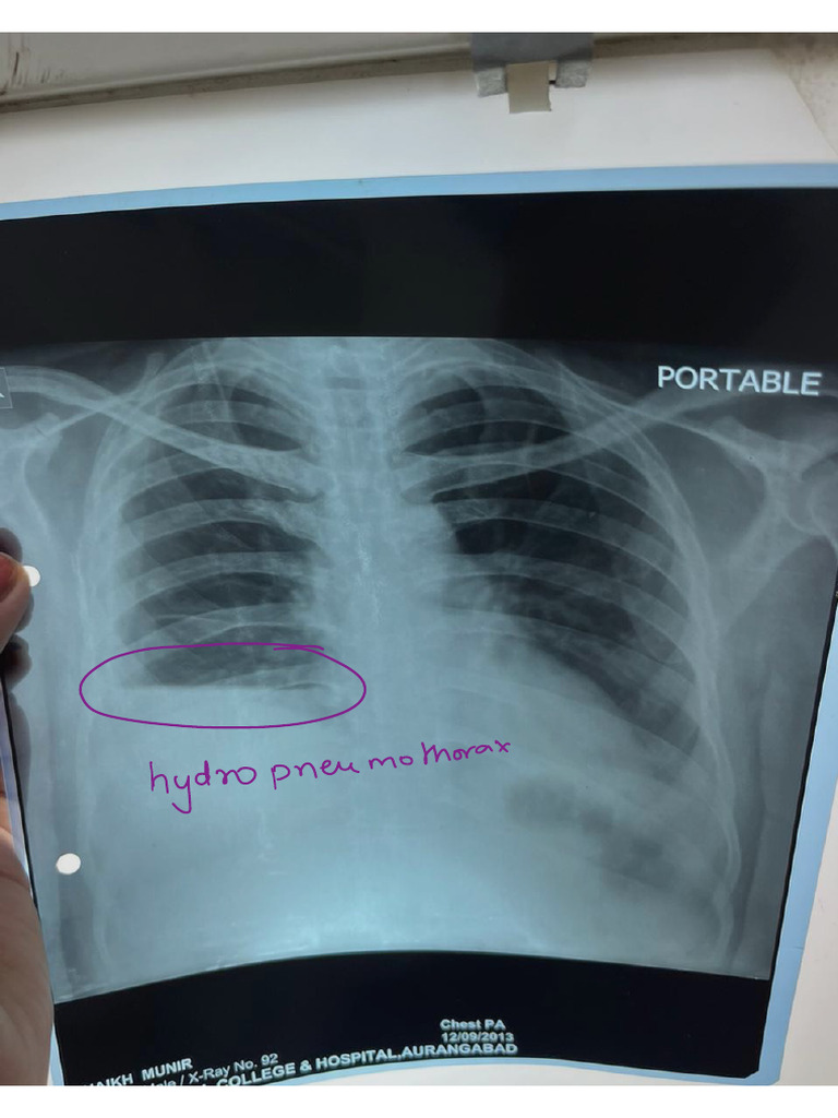 Medicine Xray 2 | PDF