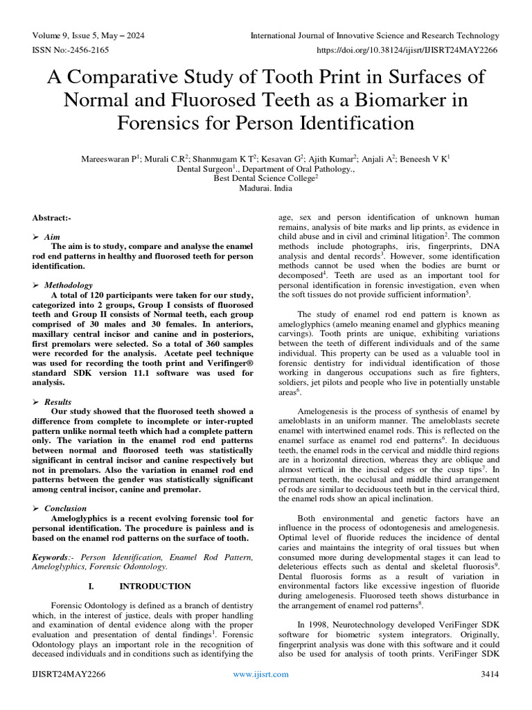 A Comparative Study of Tooth Print in Surfaces of Normal and Fluorosed ...