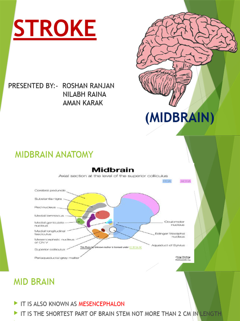 Stroke New | PDF | Stroke | Medical Specialties