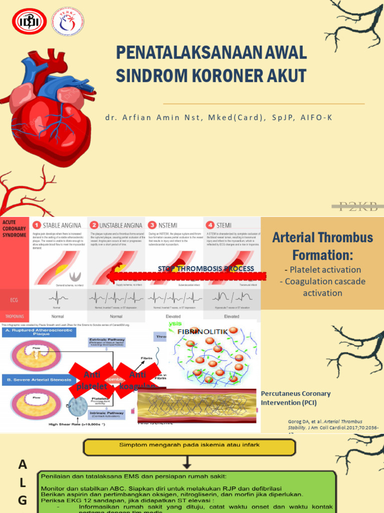 Penatalaksanaan Awal Sindrom Koroner Akut: Dr. Arfianamin NST, Mked ...
