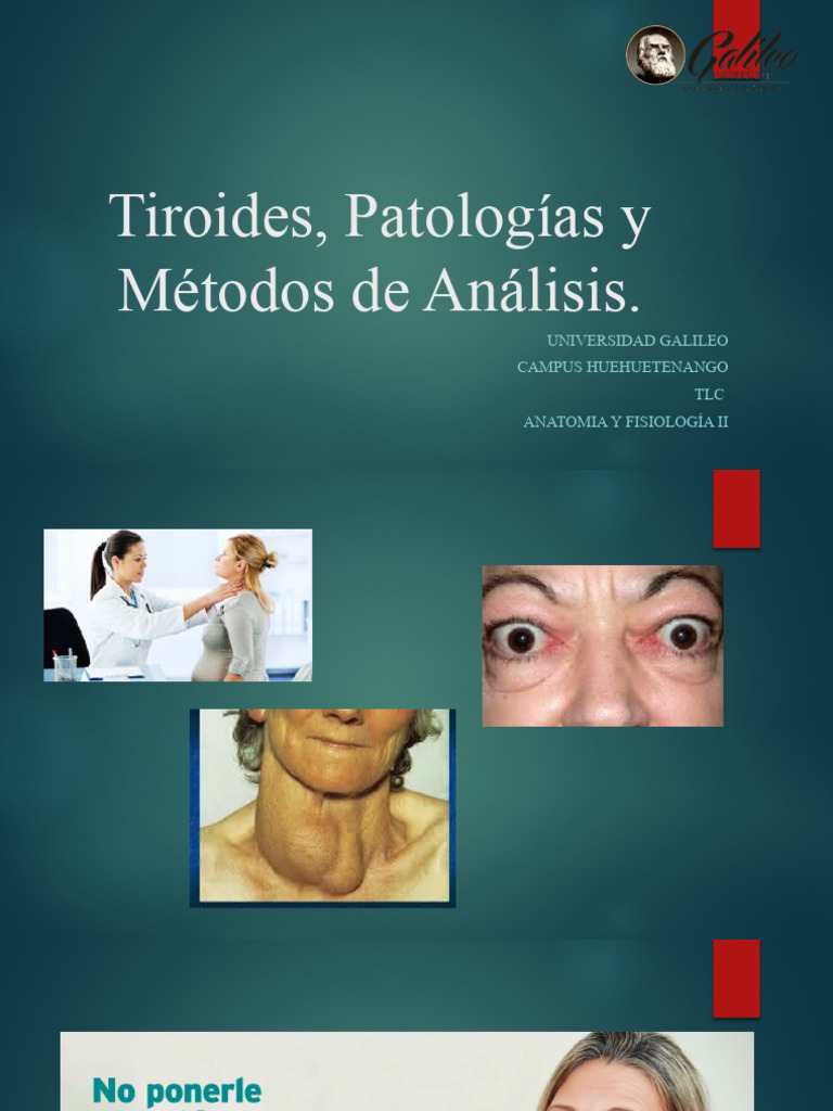 Tiroides Patolog As y M Todos de An Lisis | PDF | Tiroides | Hipertiroidismo