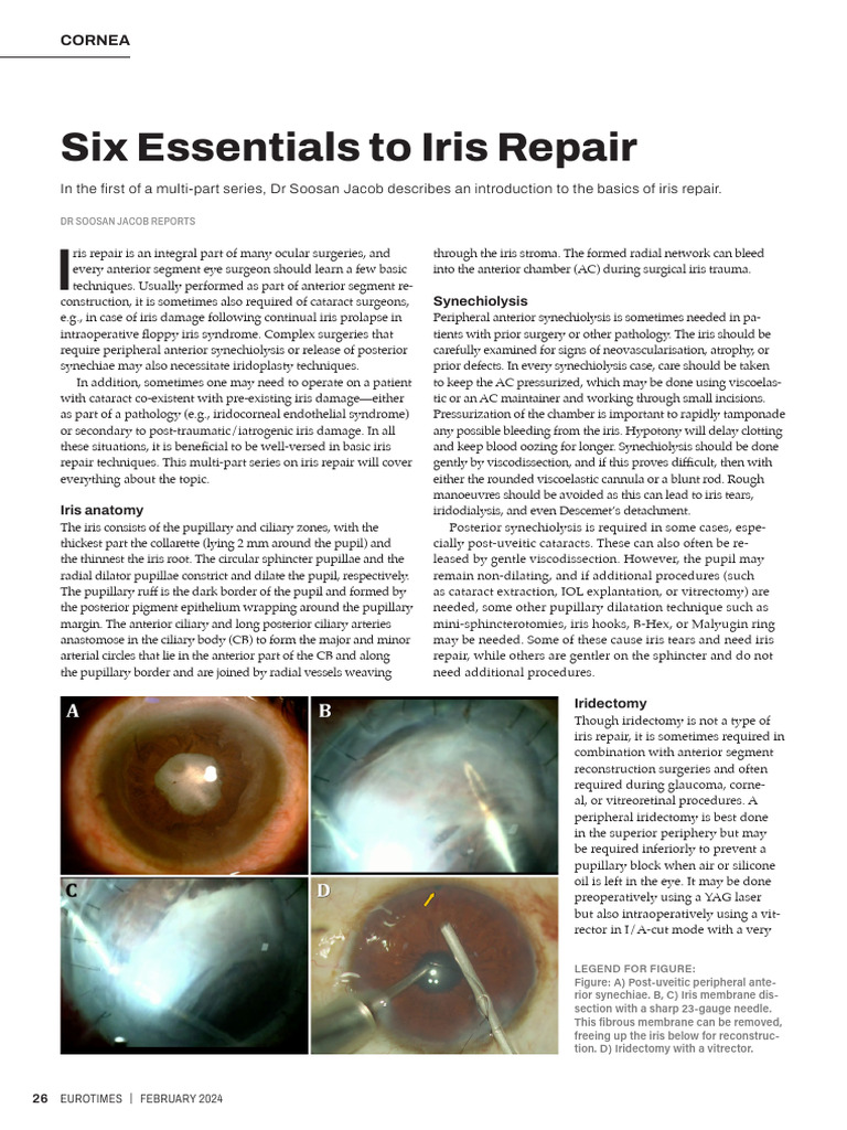 Iris Repair | PDF | Eye | Vision