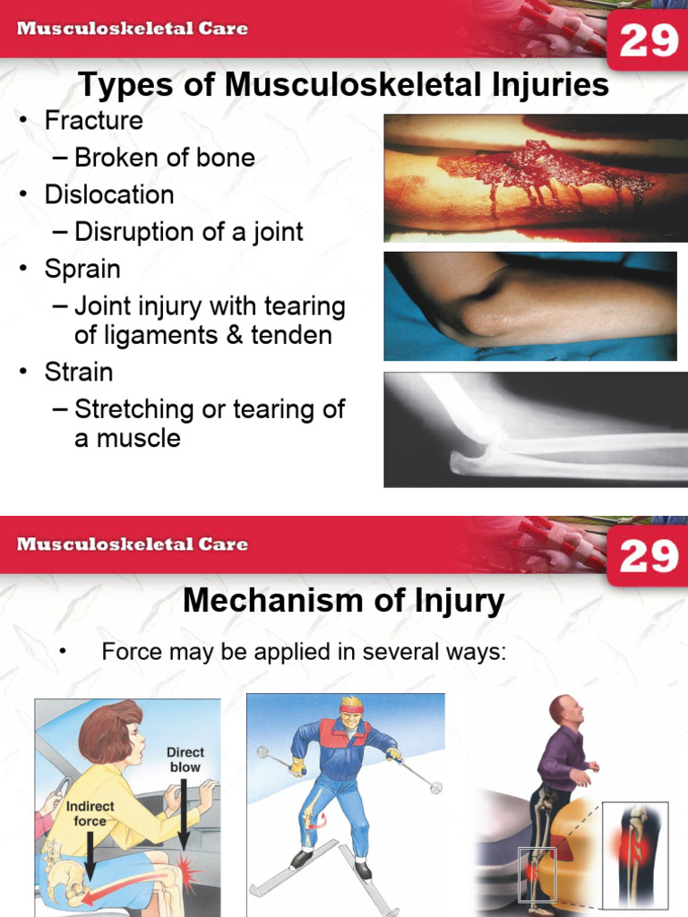 Understanding Musculoskeletal Injuries | PDF | Knee | Hip