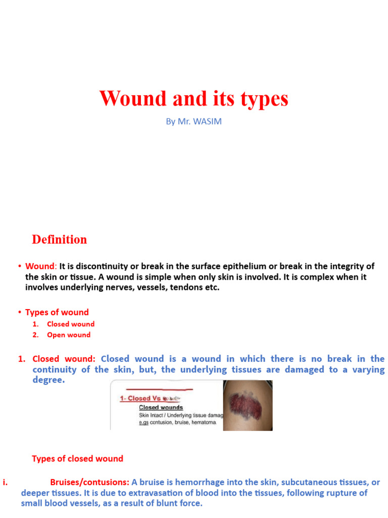 Wound and Its Types | PDF | Skin | Wound