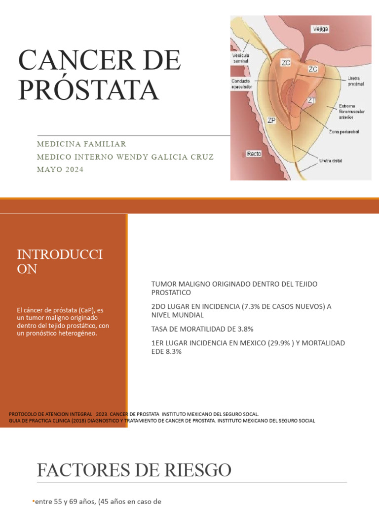 Cancer de Próstata | PDF | Cancer de prostata | Cáncer
