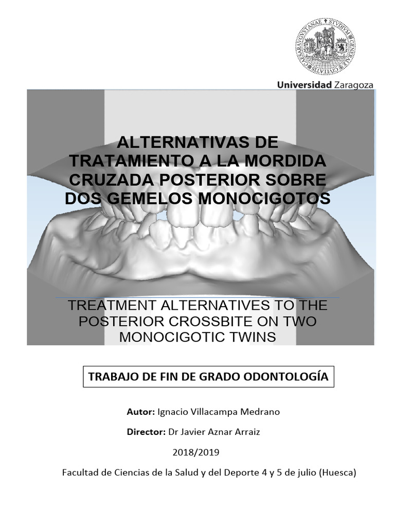 TAZ-TFG-2019-1562 | Descargar gratis PDF | Ortodoncia | Diente