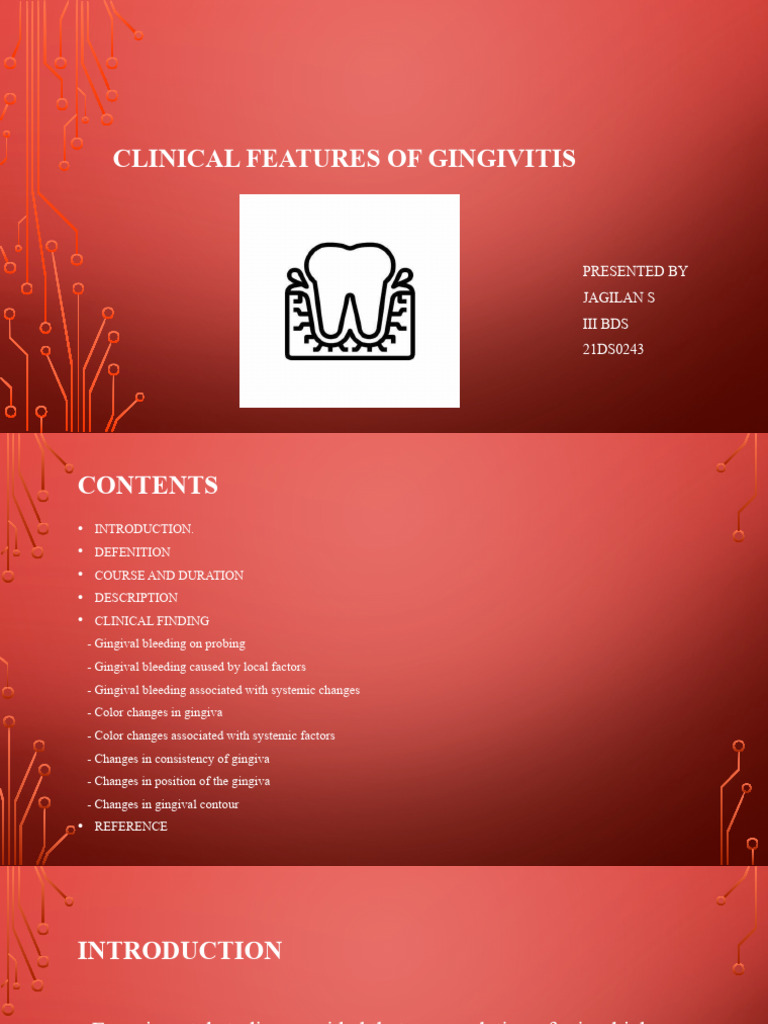 Clinical Features of Gingivitis | PDF | Periodontology | Inflammation