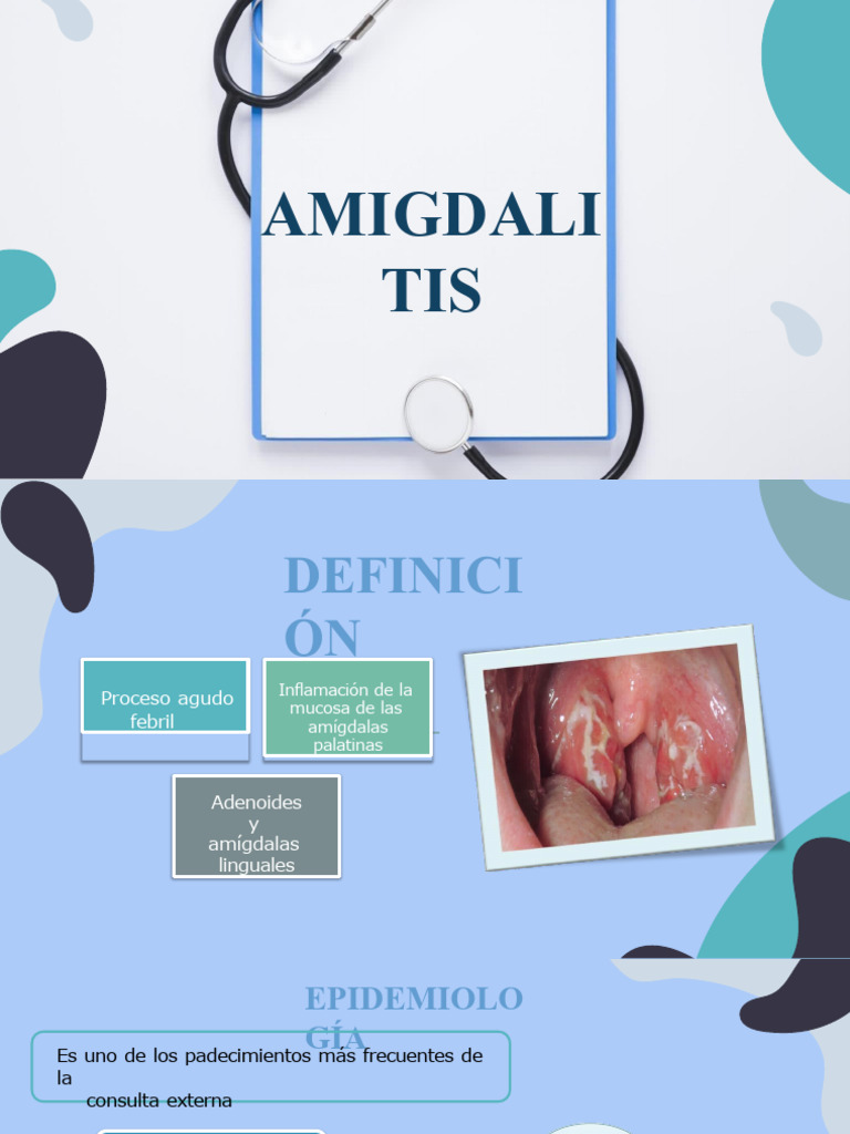 AMIGDALITIS | Descargar gratis PDF | Medicina | Causas de la muerte