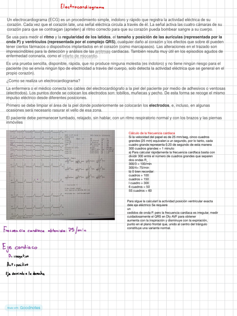 Electro | PDF | Electrocardiografia | Corazón