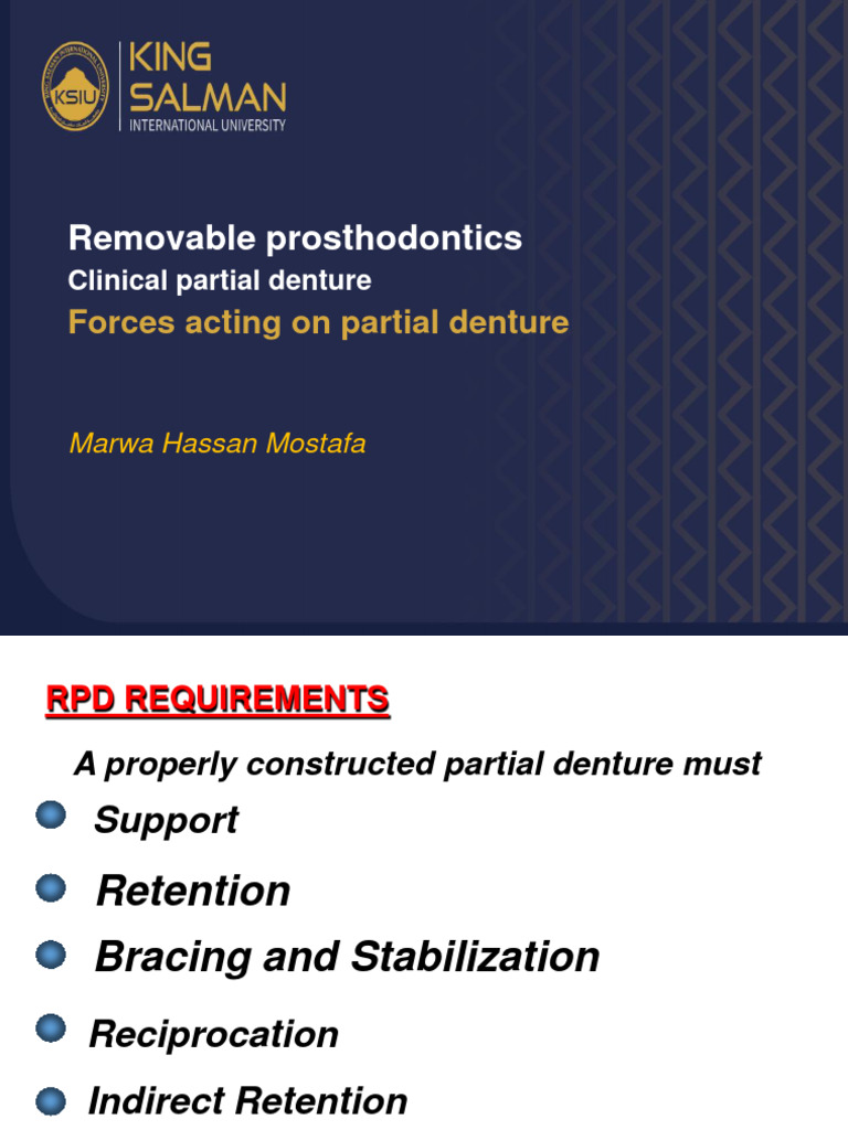 RPD Design: Forces and Movements | PDF | Dentures | Dental Anatomy