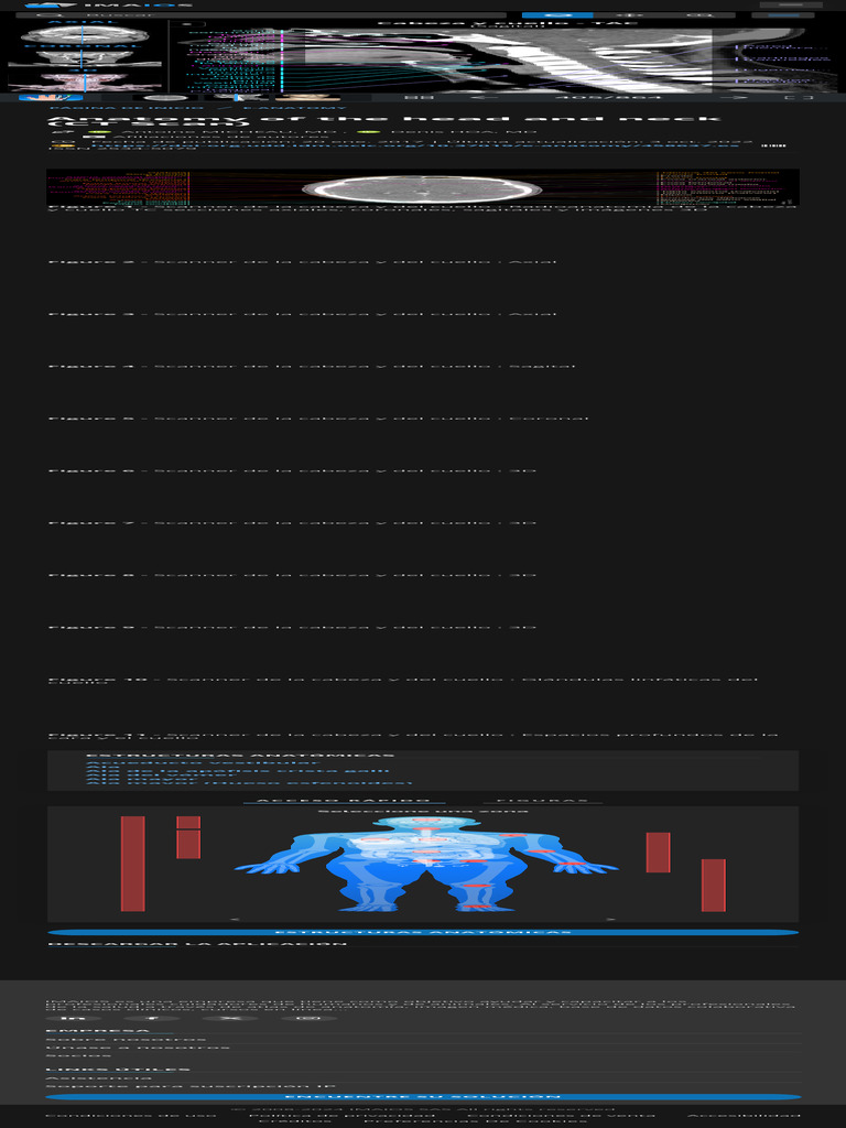 Cabeza Y Cuello Tc Anatomía Normal E Anatomy 3 Pdf