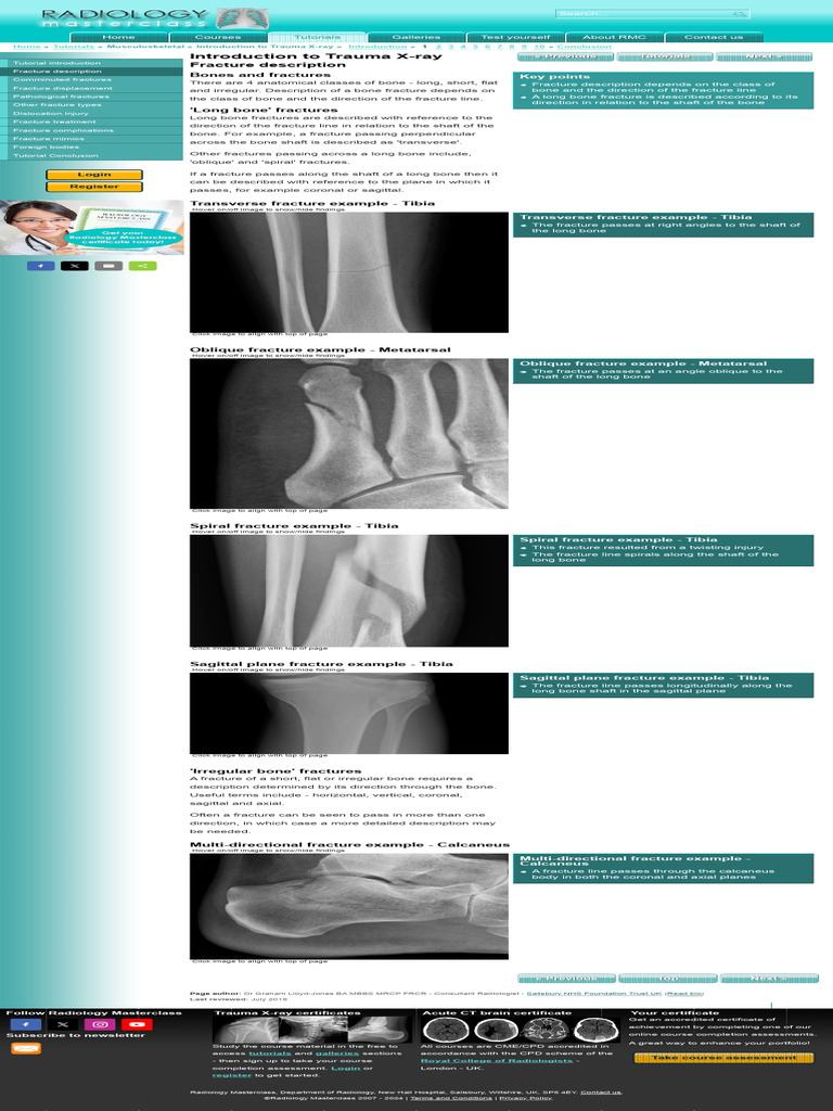 Introduction To Trauma X-Ray - Fracture Descripti | PDF | Radiology ...