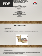 Clasificación de terceros molares | PDF