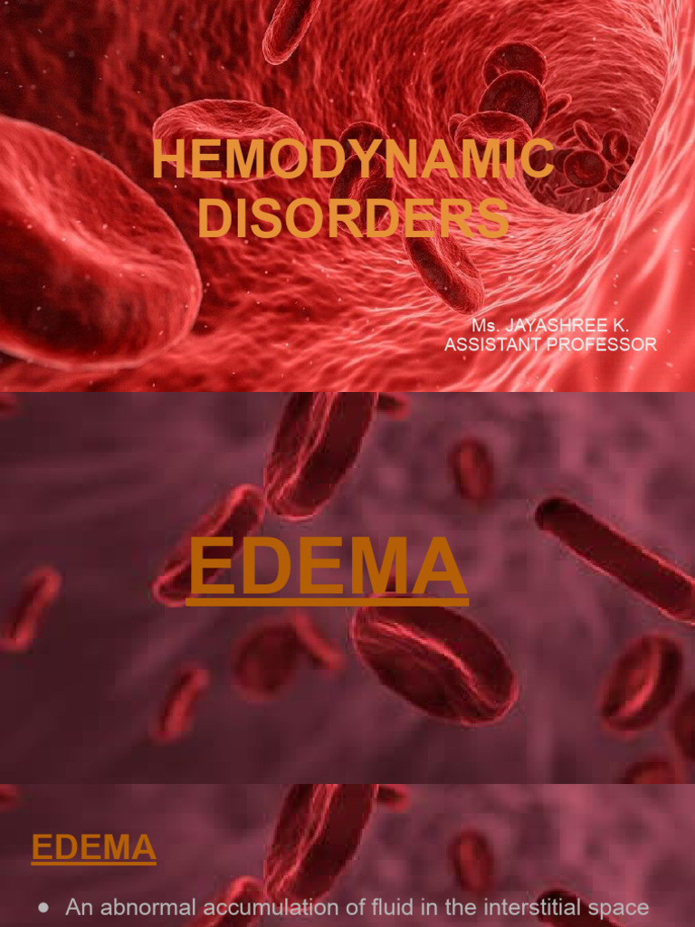 Hemodynamic Disorders | PDF | Edema | Clinical Medicine