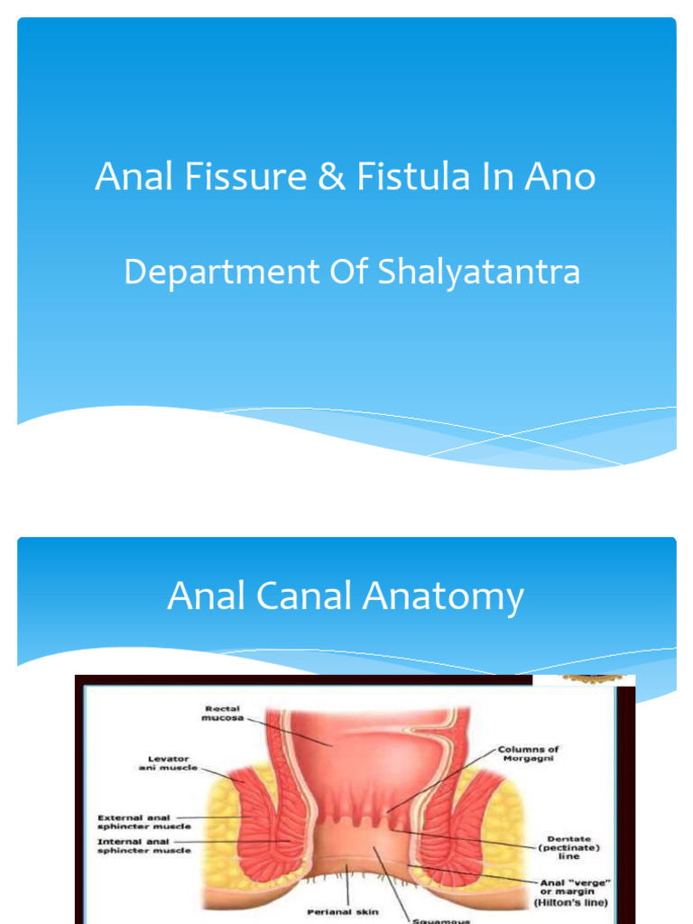 Anal Fissure & Fistula in Ano | PDF | Rectum | Hemorrhoid