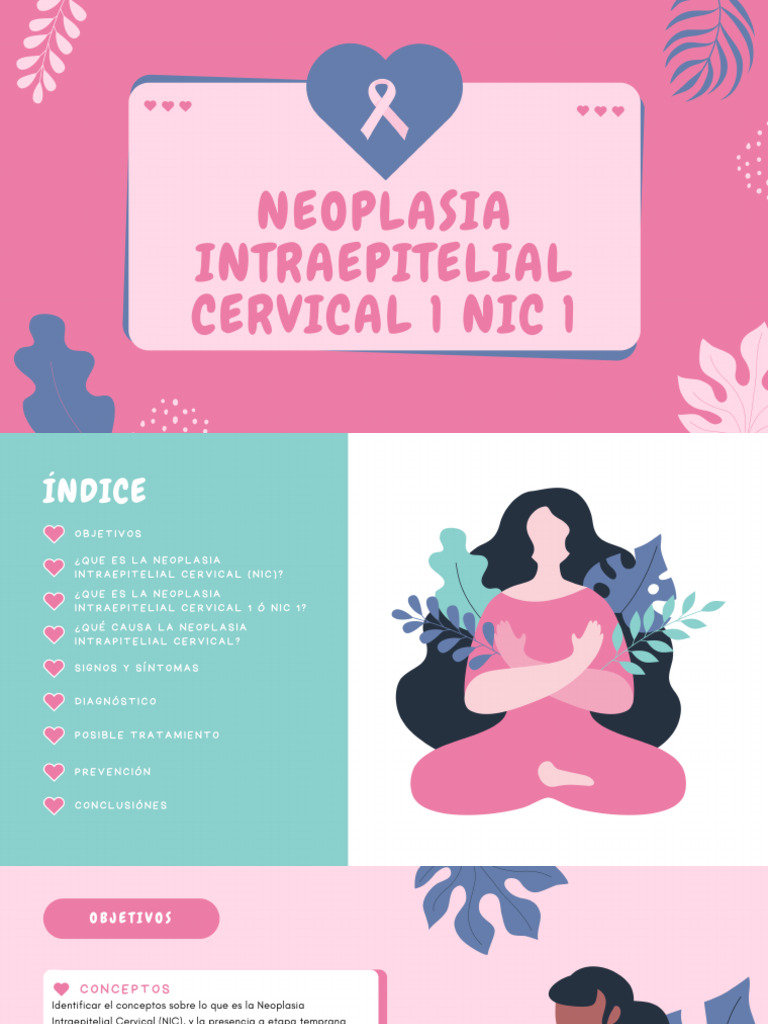 Presentación NIC 1 | PDF