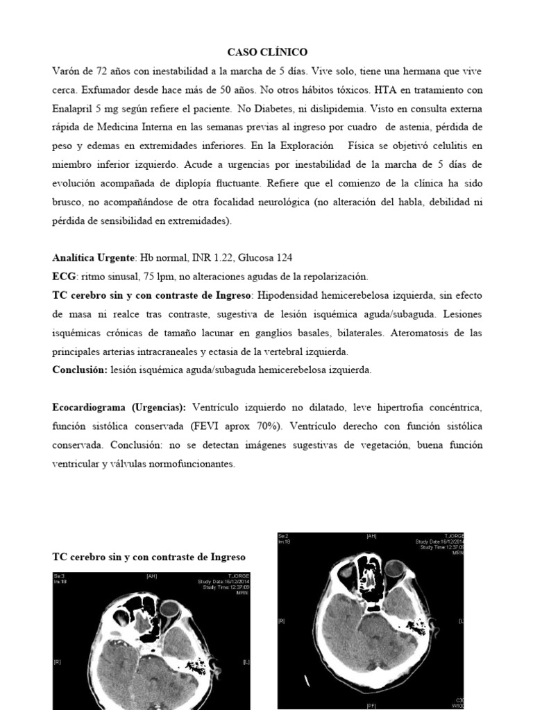 caso clinico AVC | PDF | Trombosis | Medicina CLINICA