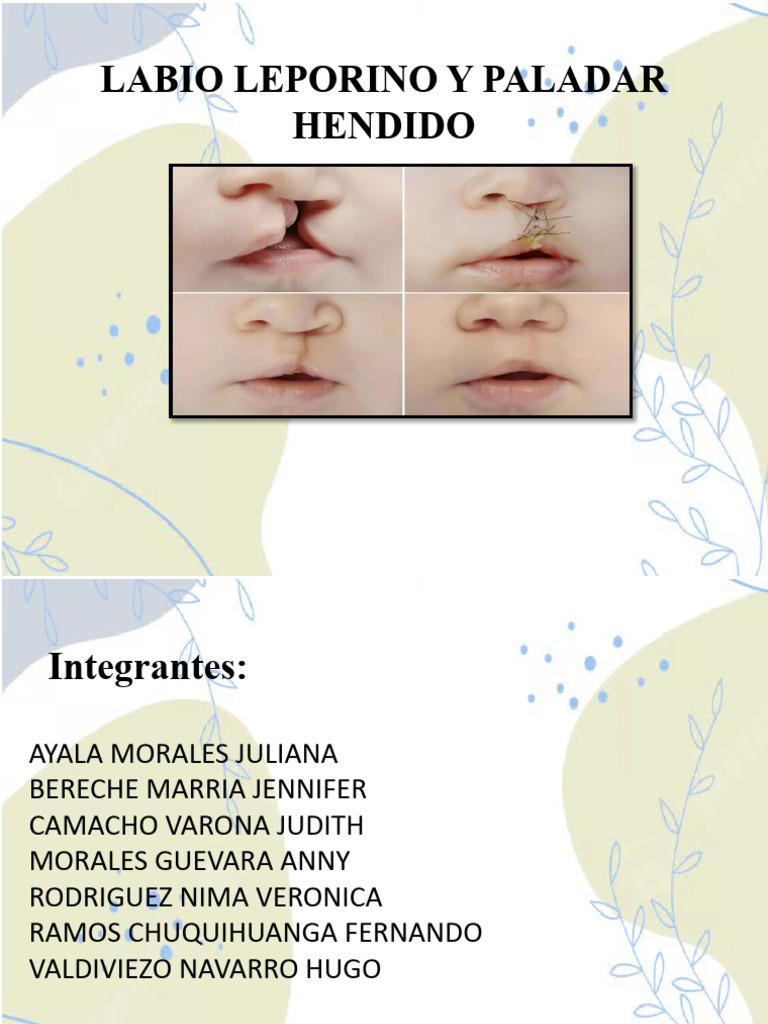 Labio Leporino y Paladar Hendido | PDF | El embarazo | Especialidades ...