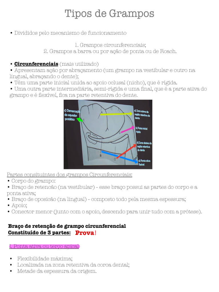PPR - Tipos de Grampos | PDF | Dente humano