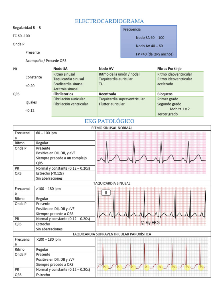 EKG PATOLÓGICO | Descargar gratis PDF | Electrocardiografia ...