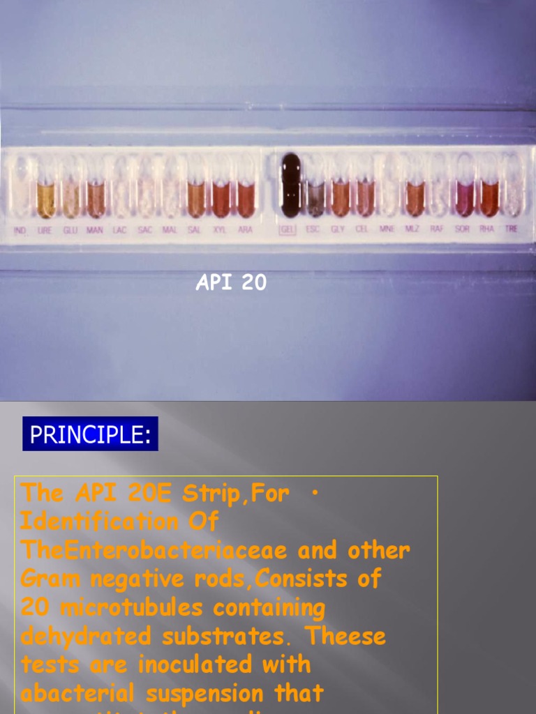 Api 20 | PDF | Chemical Substances | Chemistry