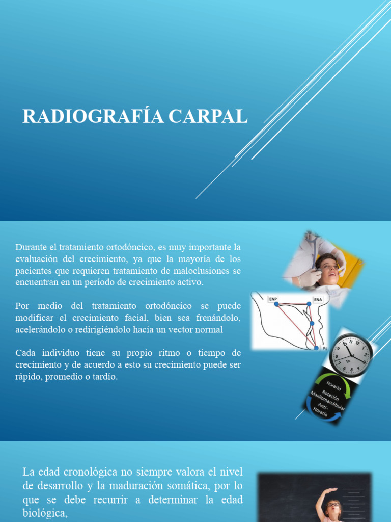 Radiografia Carpal | PDF | Mano | Sistema musculoesquelético
