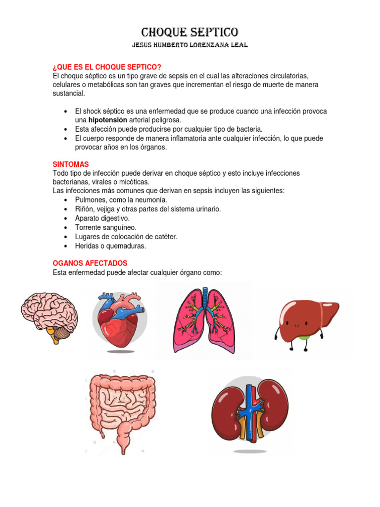 Que Es El Choque Septico | PDF | Septicemia | Choque (circulatorio)