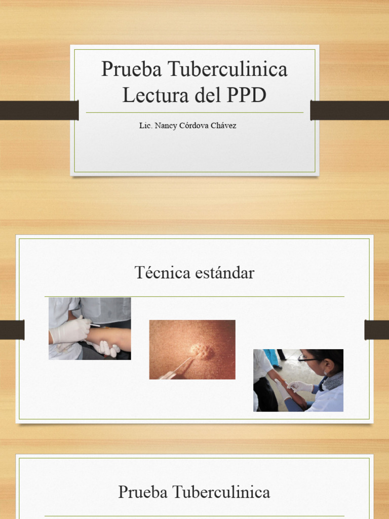 Tema 05 Lectura de Ppd | PDF | Tuberculosis | Ciencias de la Salud