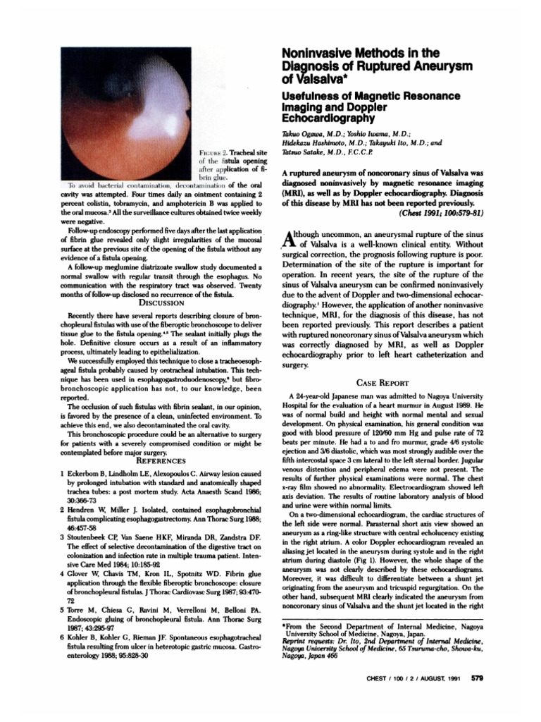 Noninvasive Methods in The Diagnosis of Ruptured A | PDF | Heart ...