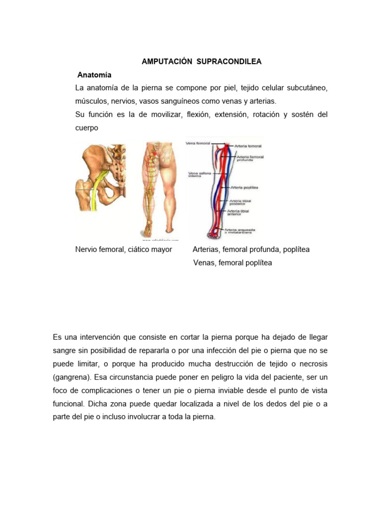 Amputacion Supracondilea | PDF | Cirugía | Pie