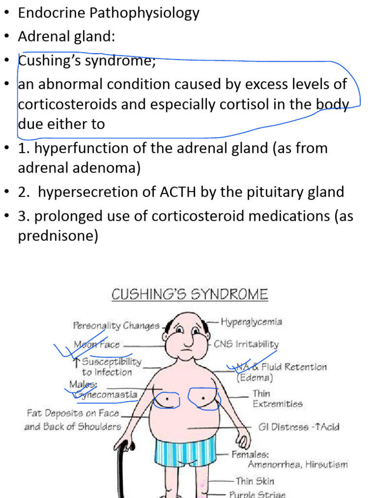 6 - Endocrine Pathophysiology | PDF | Diabetes | Thyroid